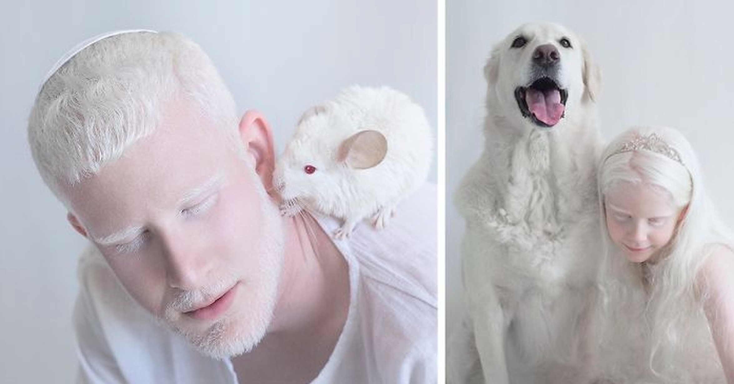 ¡Cuánta razón! / Fotógrafo se dedica a capturar la belleza de los albinos