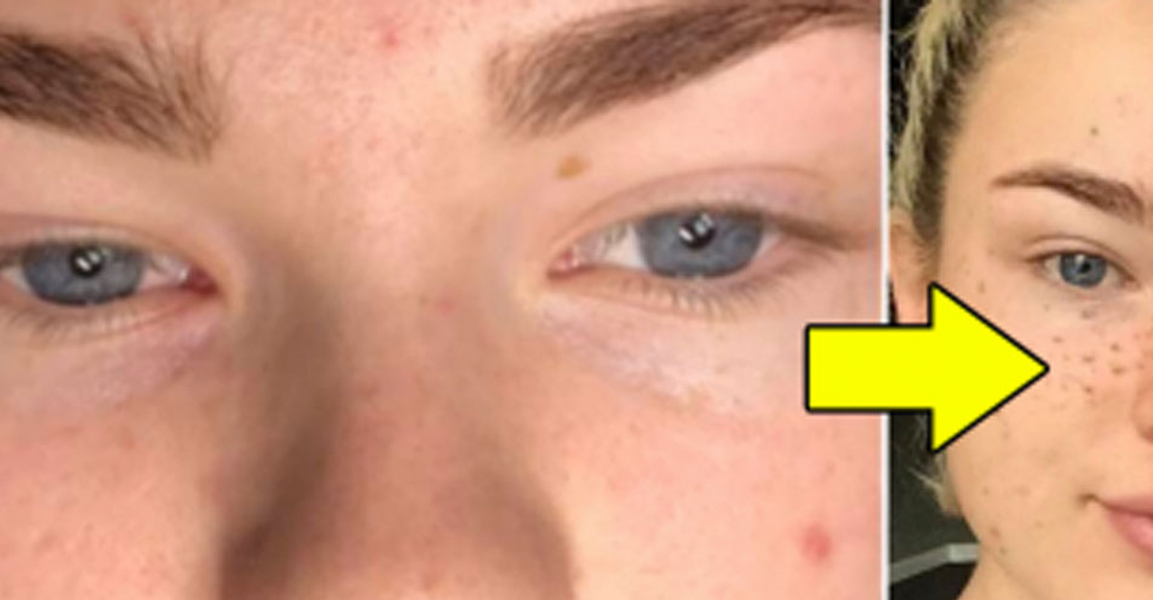 ¡Cuánta razón! / Freckling: La nueva tendencia de la moda que consiste ...