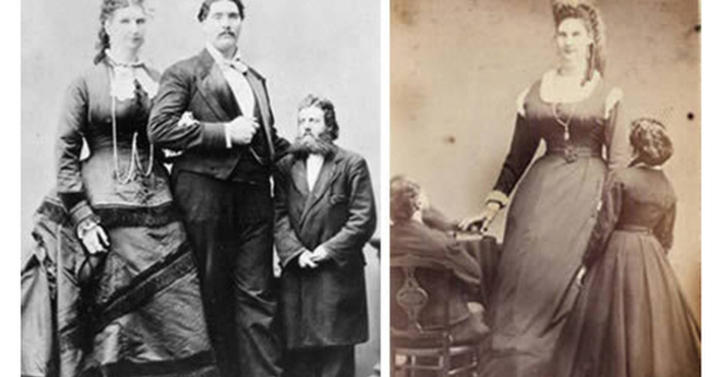 ¡Cuánta razón! / Anna Swan y su peculiar récord