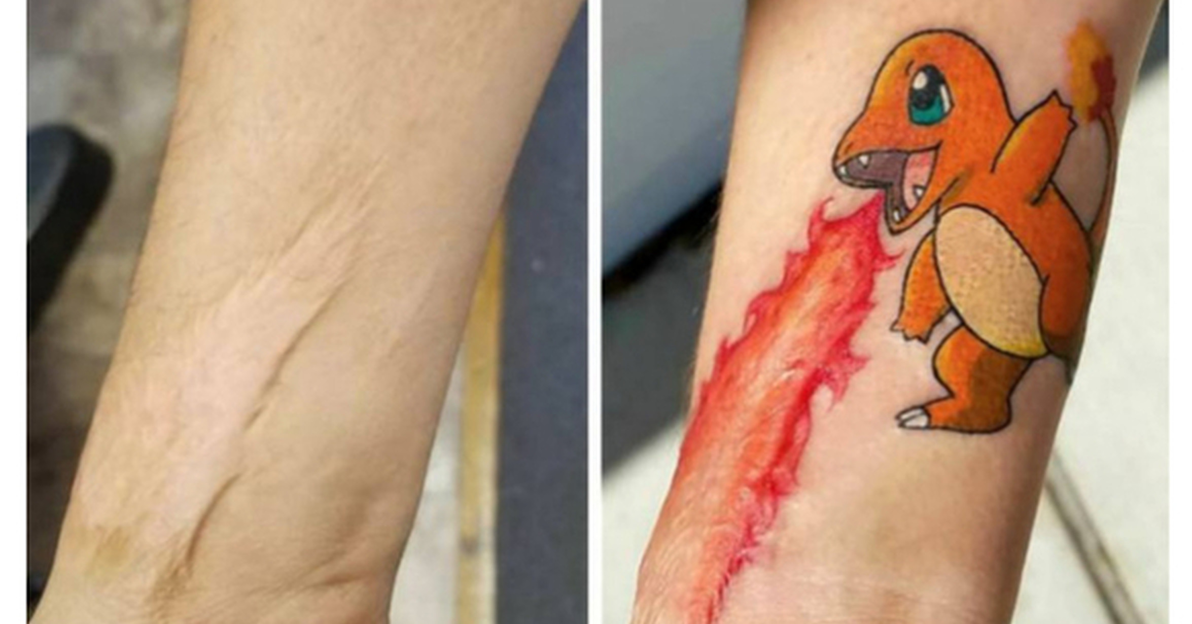 Personas que convirtieron sus defectos físicos en hermosos tatuajes