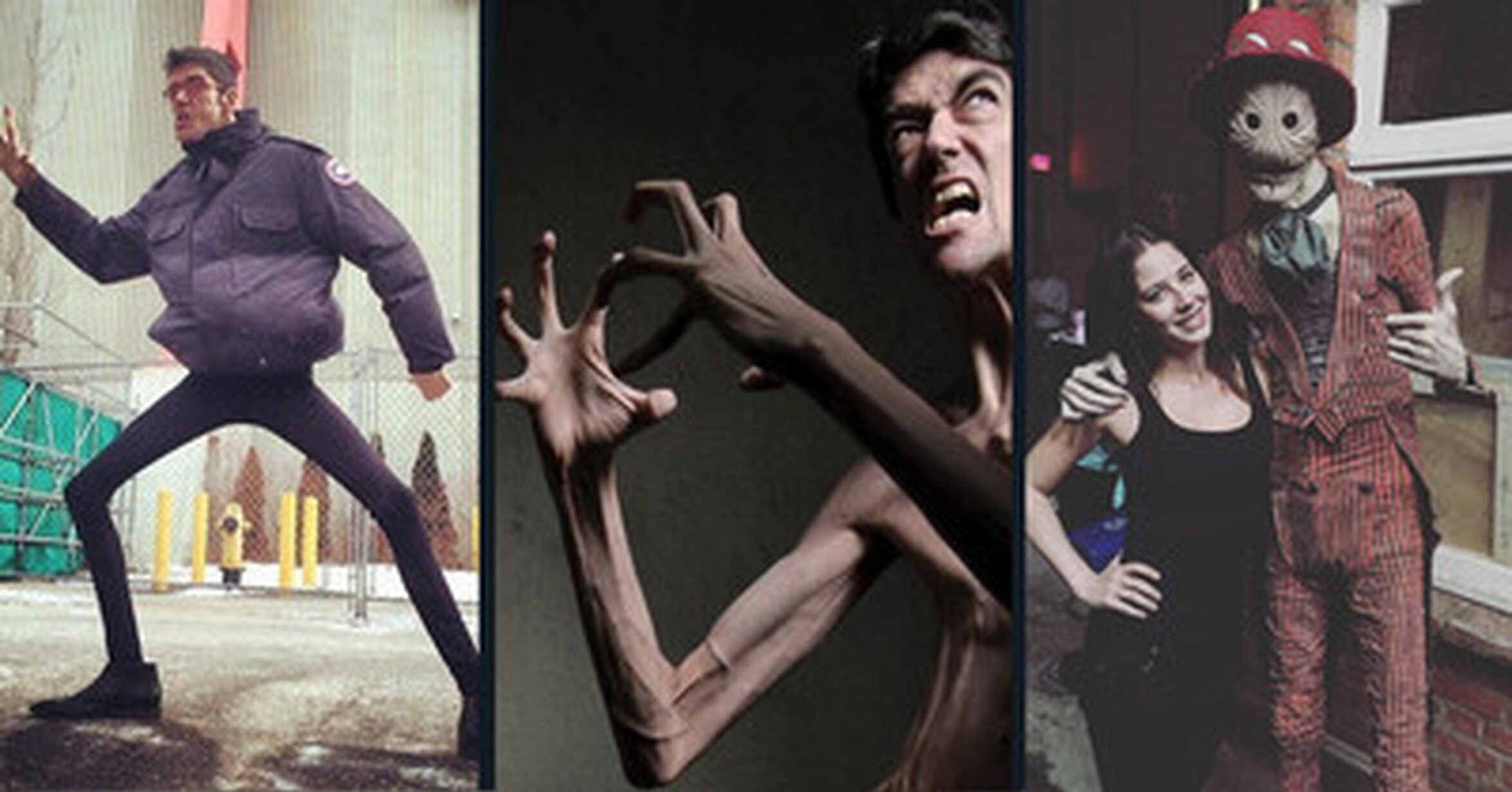 Javier Botet Sindrome De Marfan This Is Javier Botet, A Spanish Almost