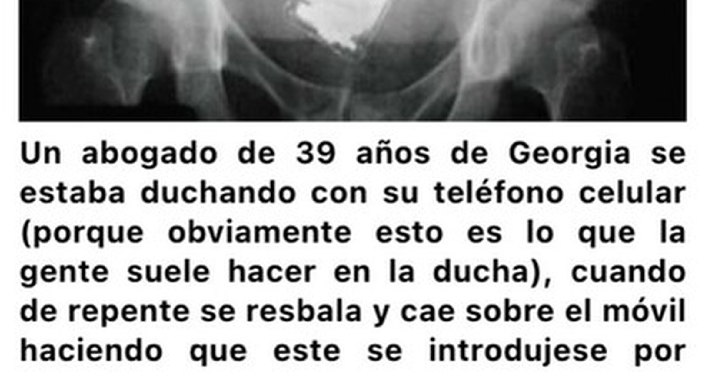 ¡Cuánta razón! / Las cosas más raras que han encontrado los médicos ...