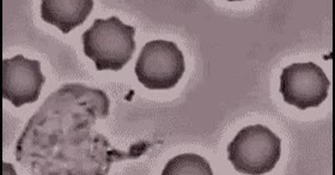 ¡Vaya GIF! / ¡Una bacteria! ¡A por ella!