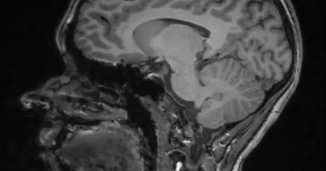 ¡Vaya GIF! / Una resonancia magnética craneal convertida en gif