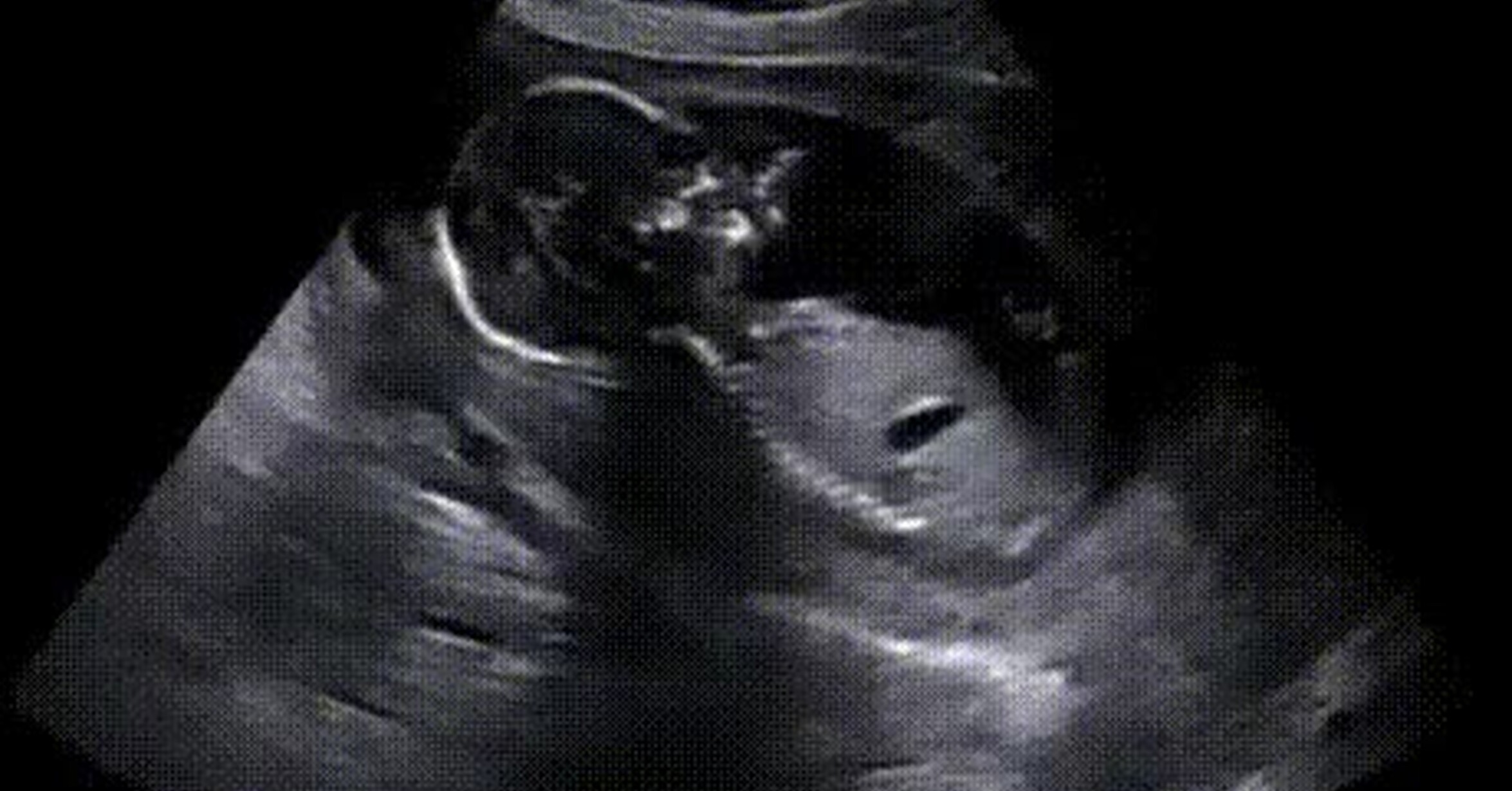 ¡Vaya GIF! / Ultrasonido de una mujer embarazada riendo