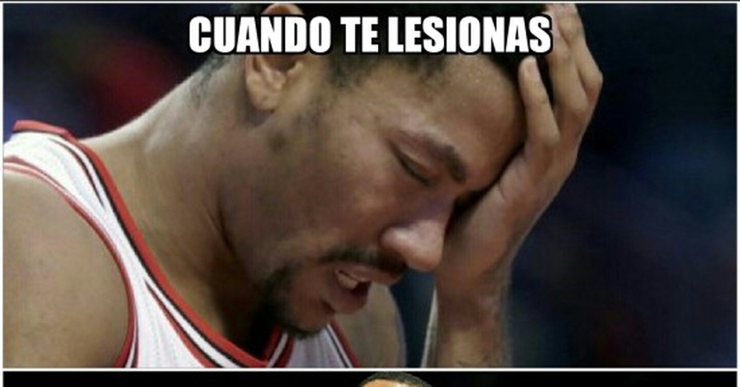 Esguince De Tobillo Memes Mbappé, Lesionado: Qué Tiene Y Cuantos