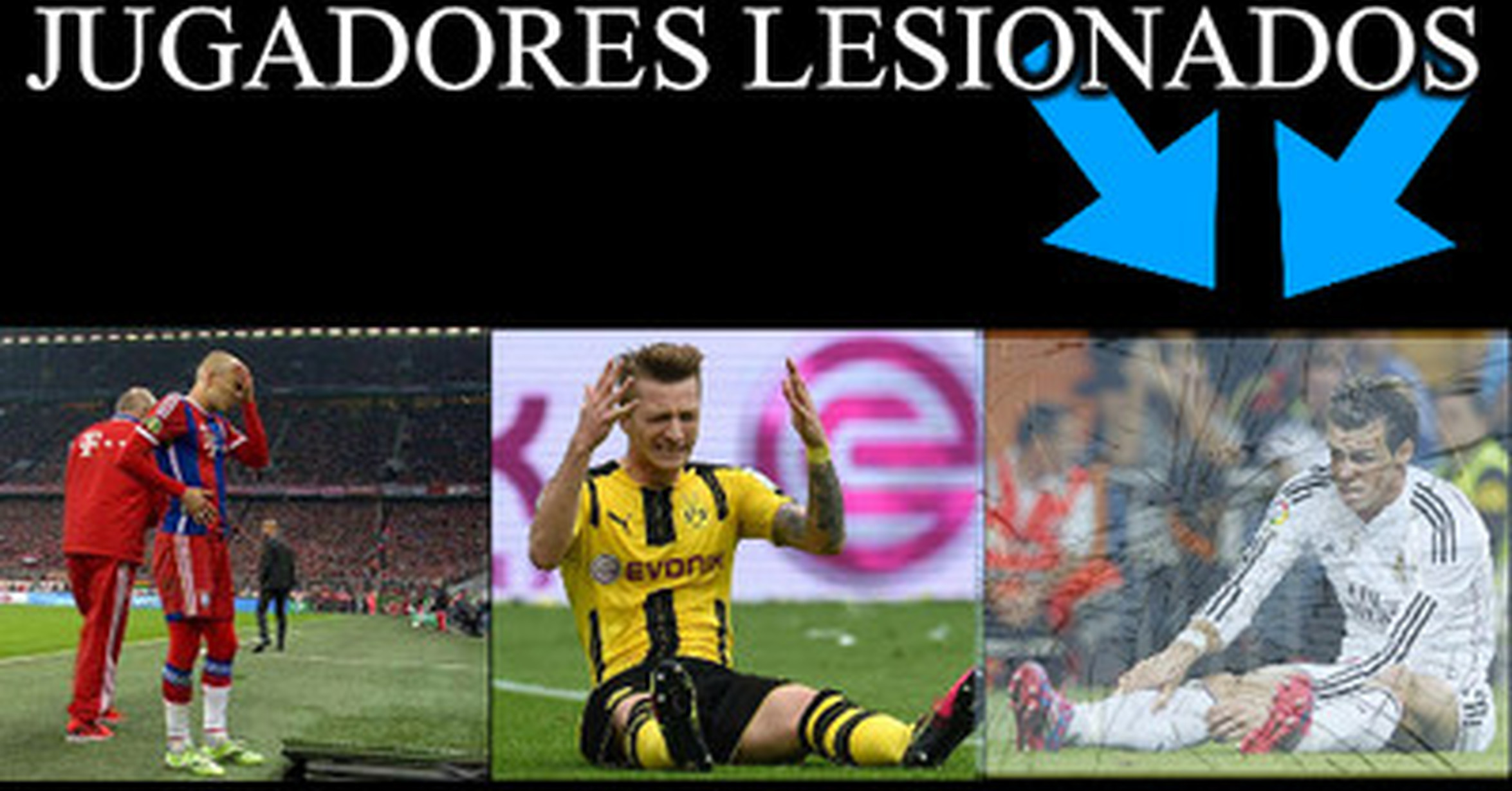 [ MEMEDEPORTES ] 3 tipos de lesionado