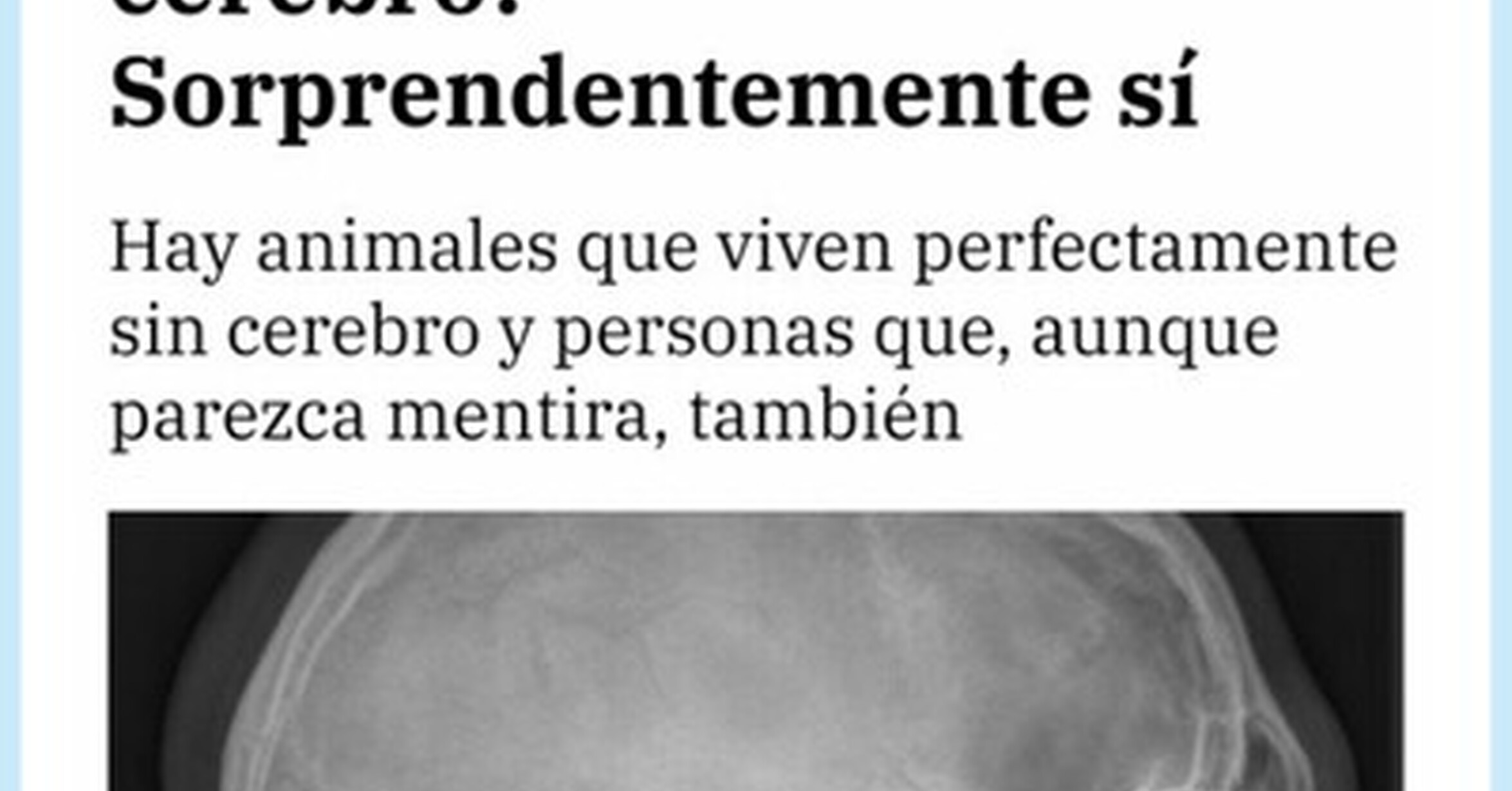 VEF > Visto en las Redes > ¿PODEMOS vivir sin cerebro? El chiste se ...