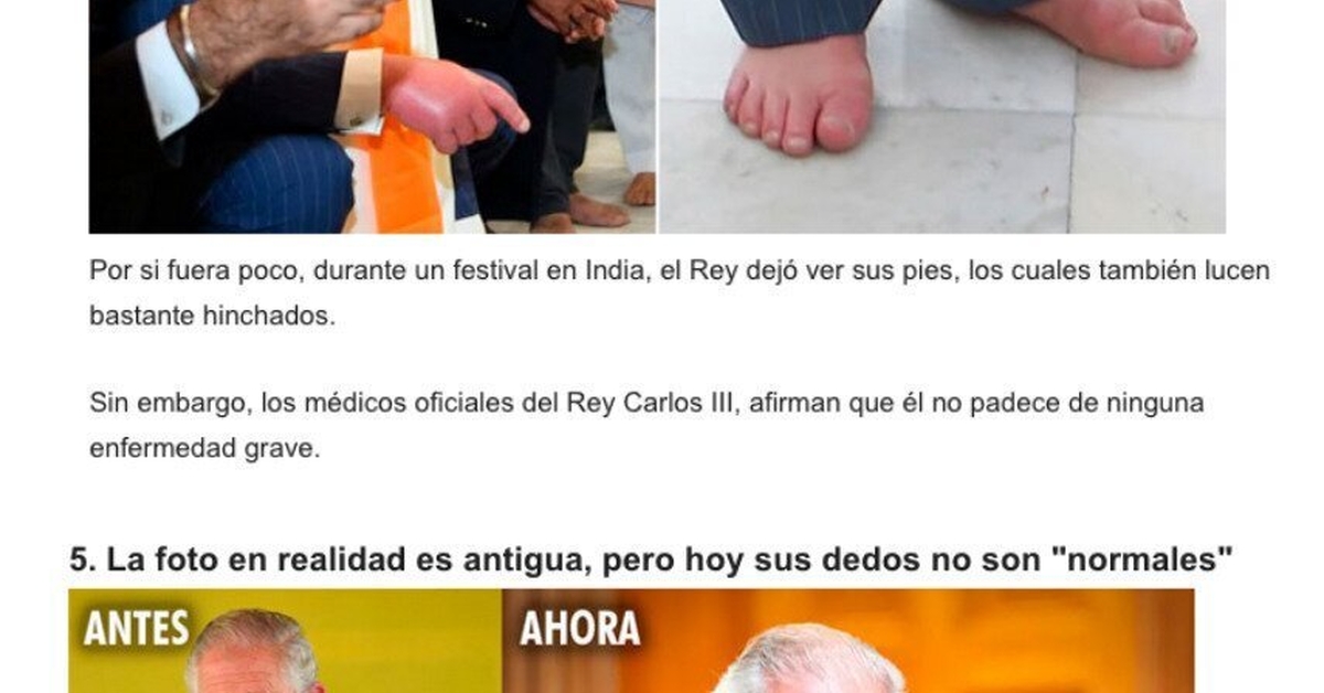 GALERÍA: 8 Puntos para entender por qué el “Rey Carlos III” tiene los ...