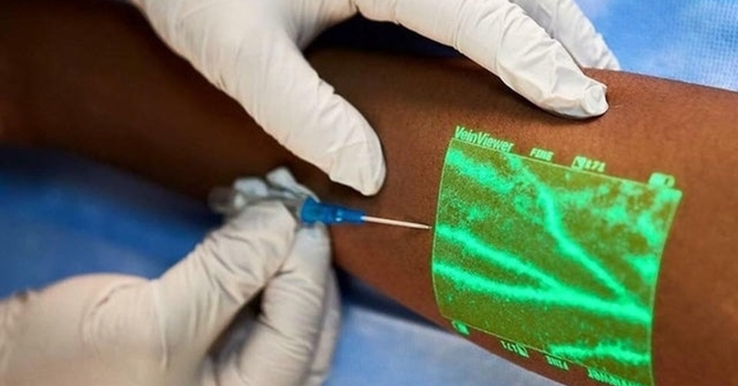 ¡Cuánta razón! / Encontrar la vena nunca fue tan fácil