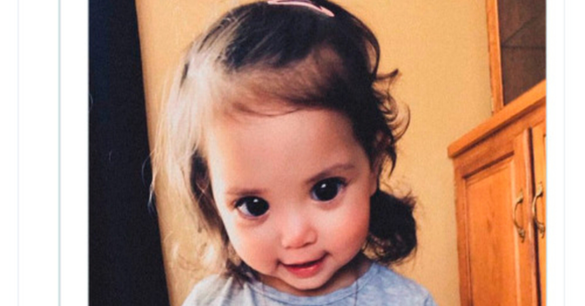 ¡Cuánta razón! / Personas únicas mostrando lo impredecible de la genética