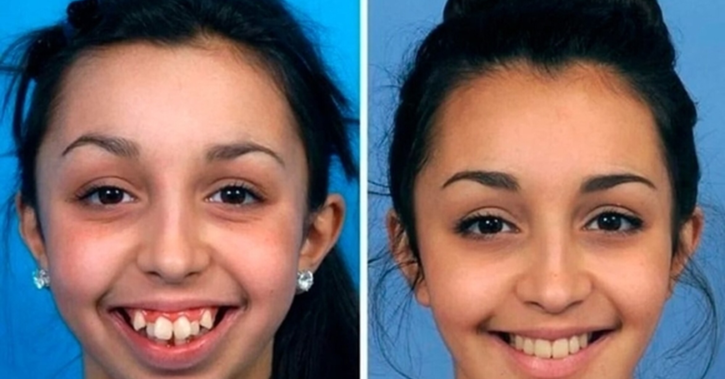 ¡Cuánta razón! / Resultado excelente