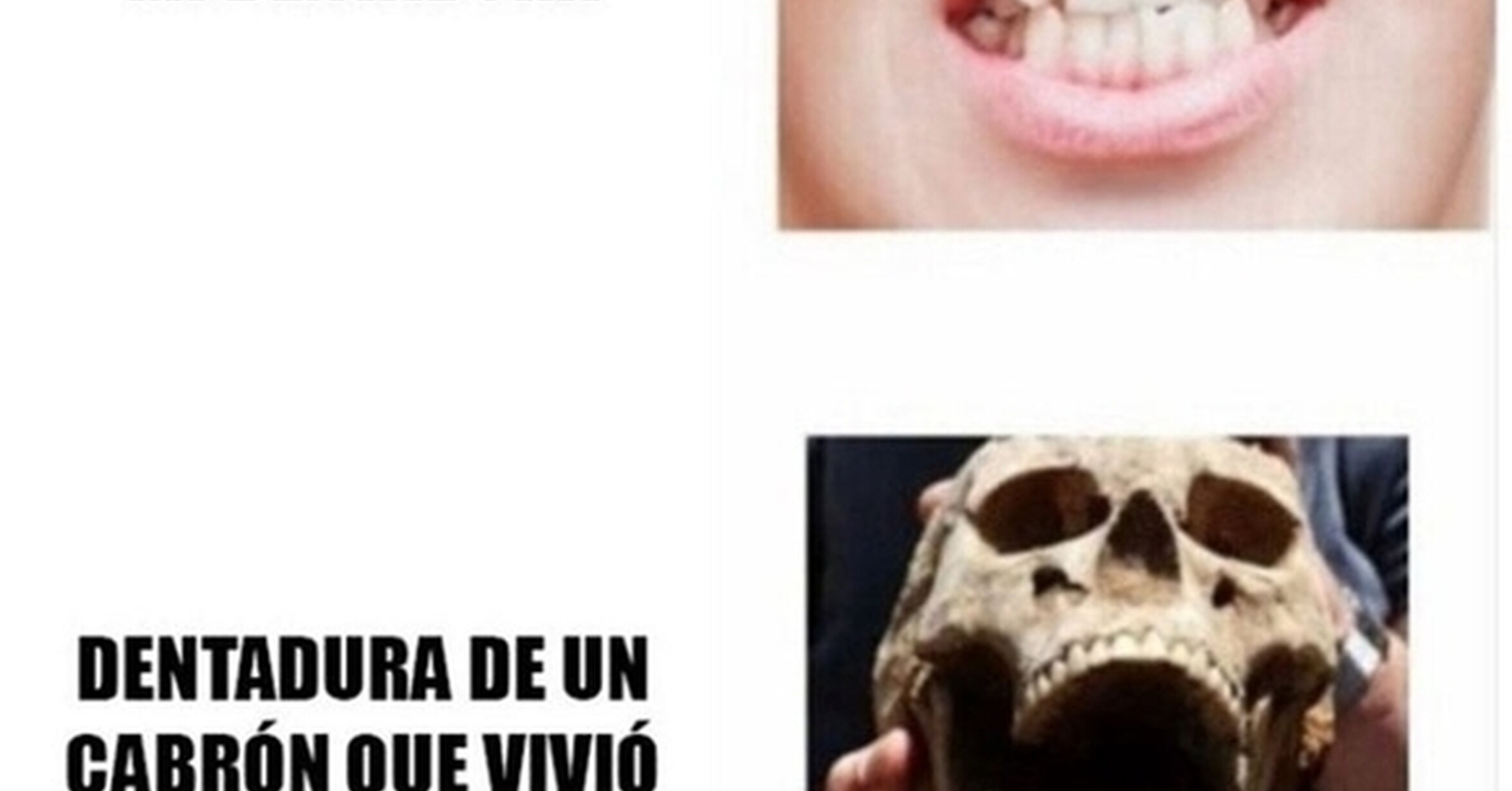 ¡Cuánta razón! / Comparando dentaduras