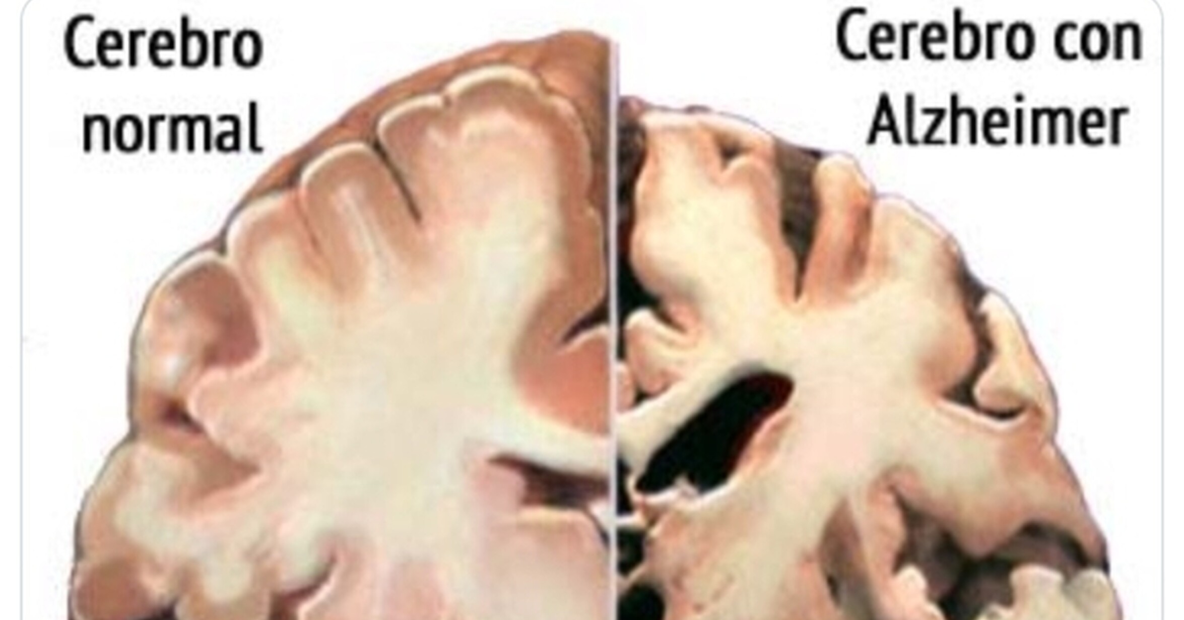 ¡Cuánta razón! / Alois Alzheimer, el neuropsiquiatra que descubrió la ...
