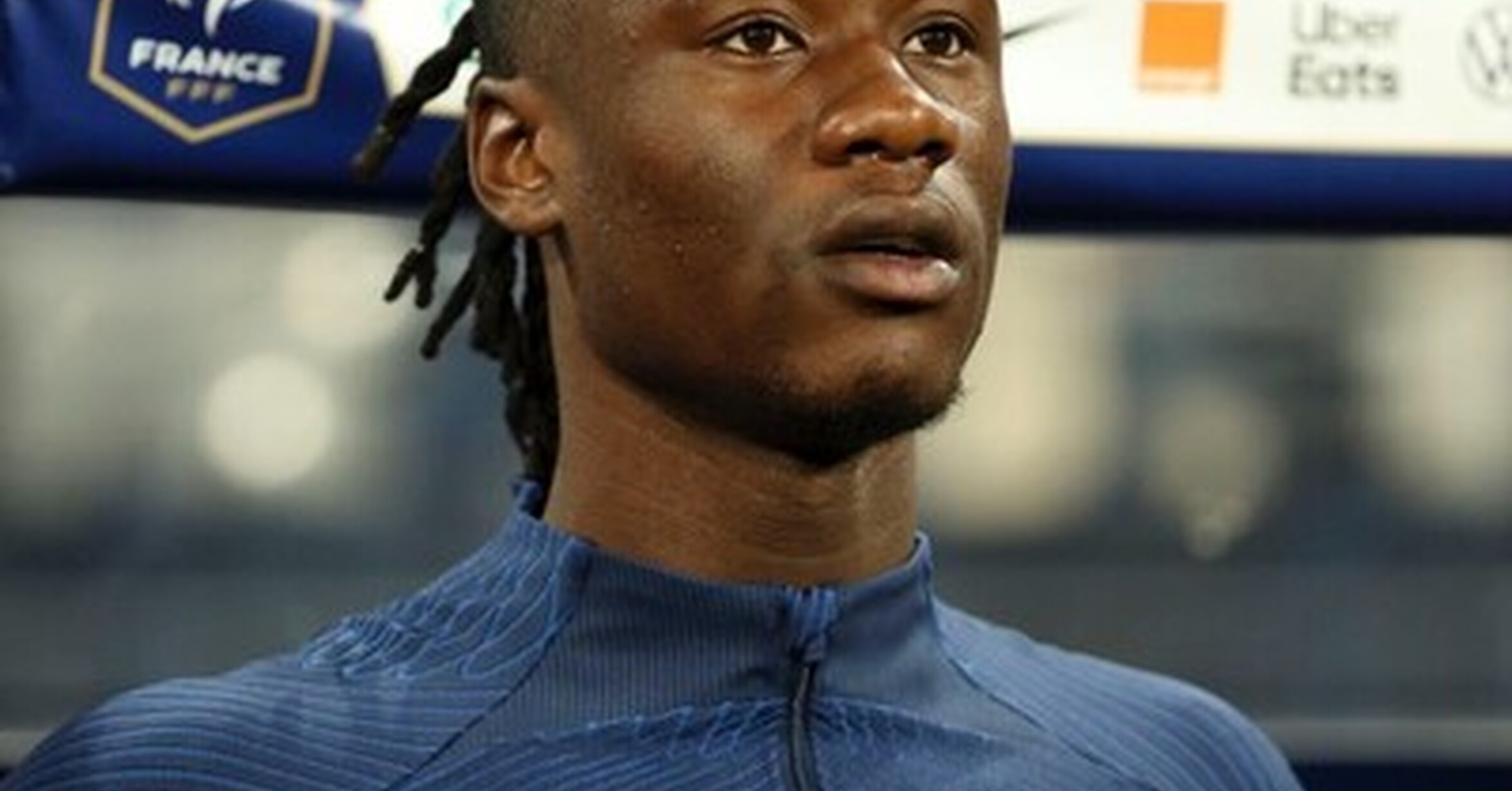 [ MEMEDEPORTES ] ¿Qué le ha pasado a Camavinga?