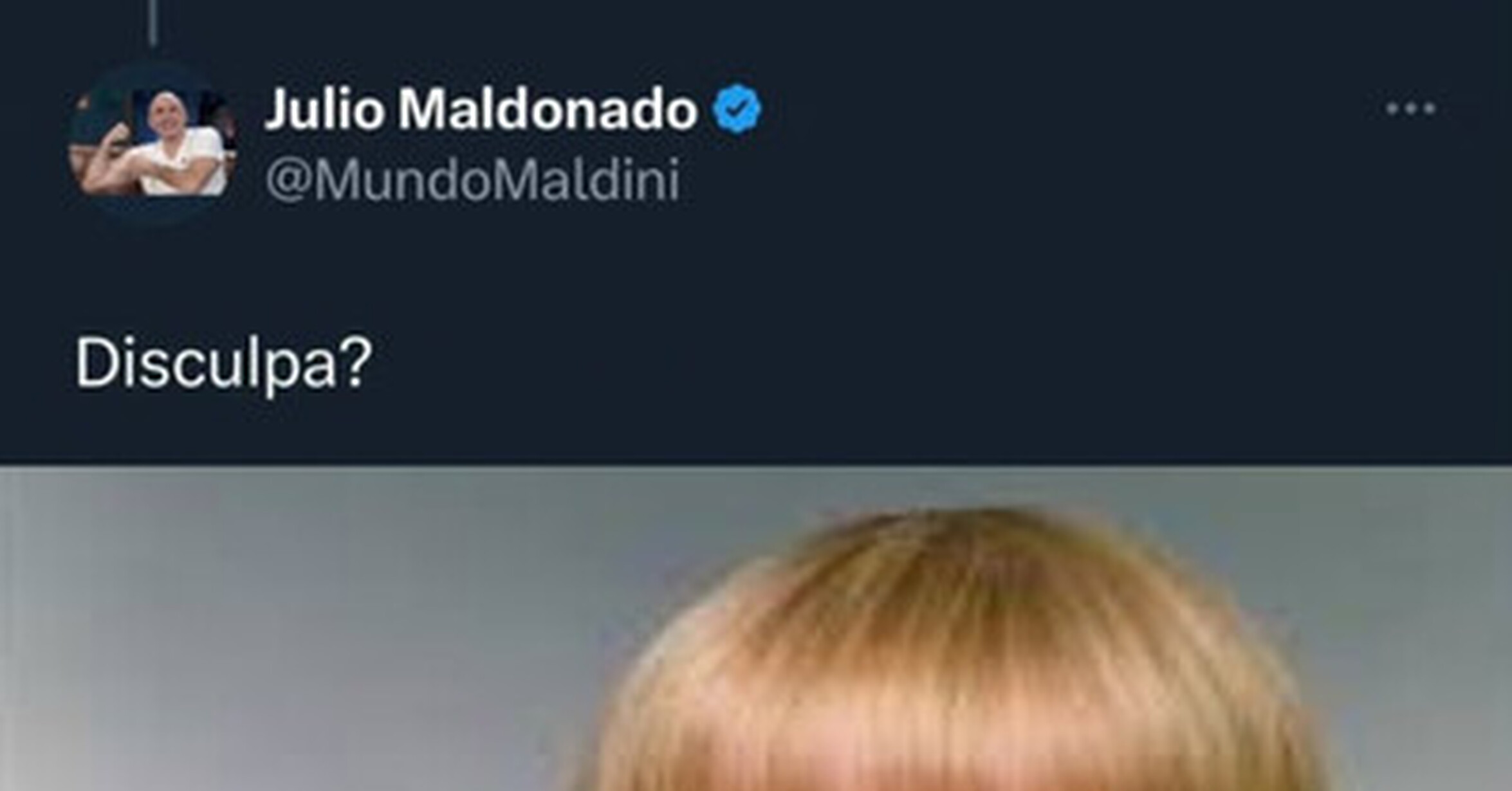 [ MEMEDEPORTES ] ¿Disculpa?