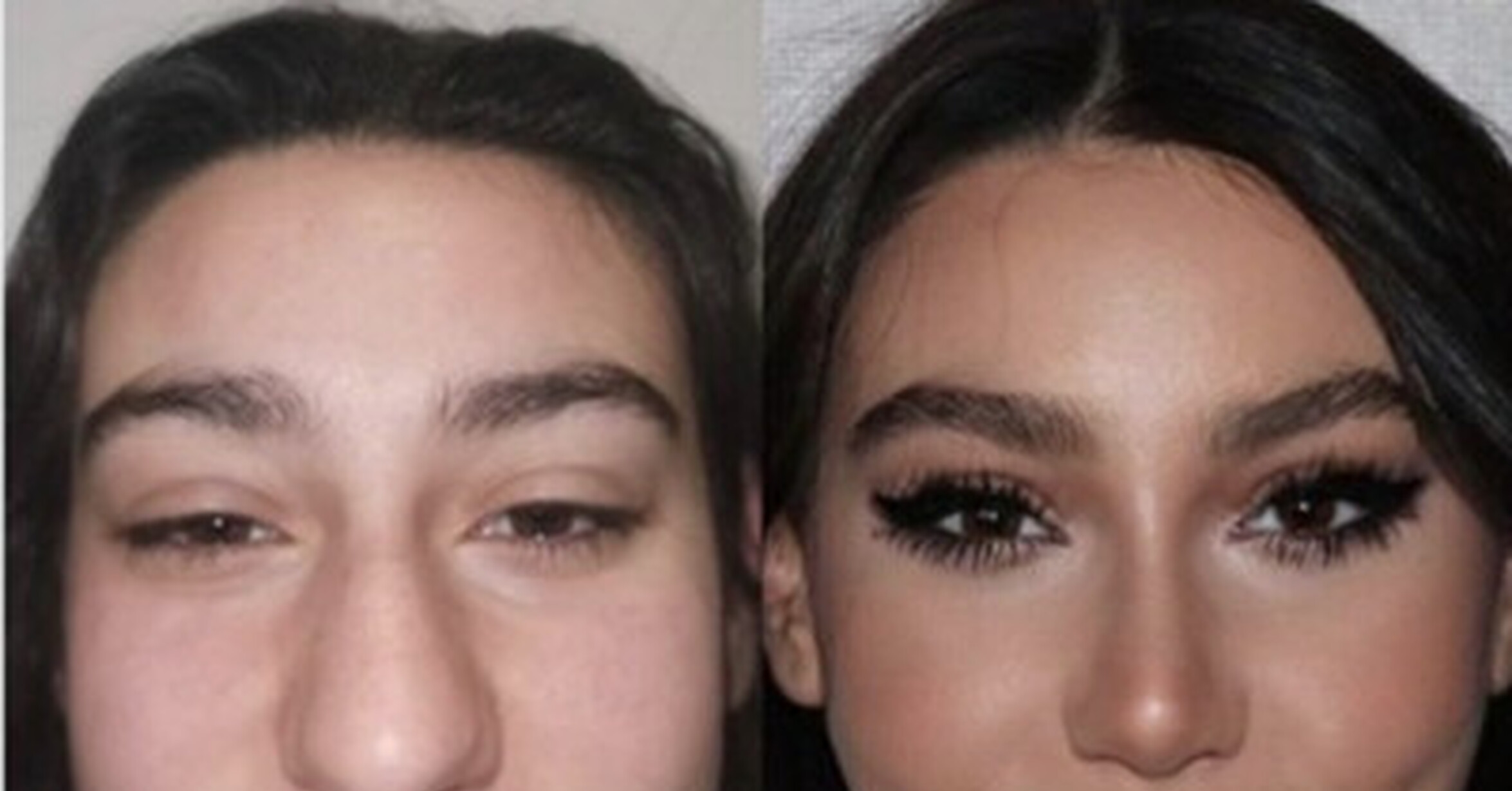 VEF > Visto en las Redes > Los cirujanos turcos están locos, menudos ...