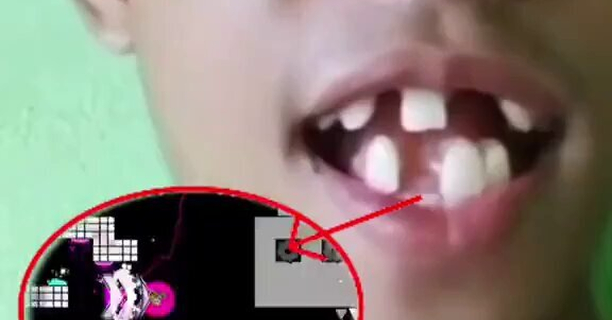 "Tienes los dientes como nivel de Geometry Dash"